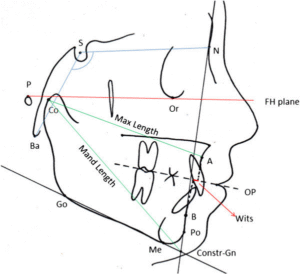 A Guide to Essential Lateral Cephalometric Landmarks - Edudentists.com ...