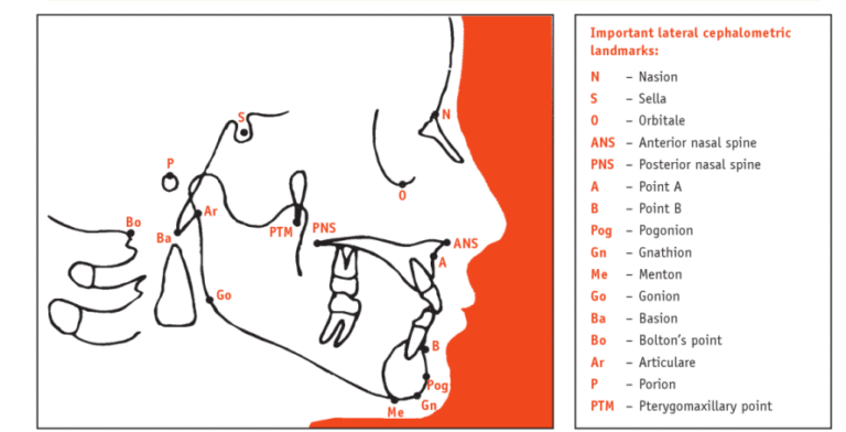 A Guide to Essential Lateral Cephalometric Landmarks - Edudentists.com ...