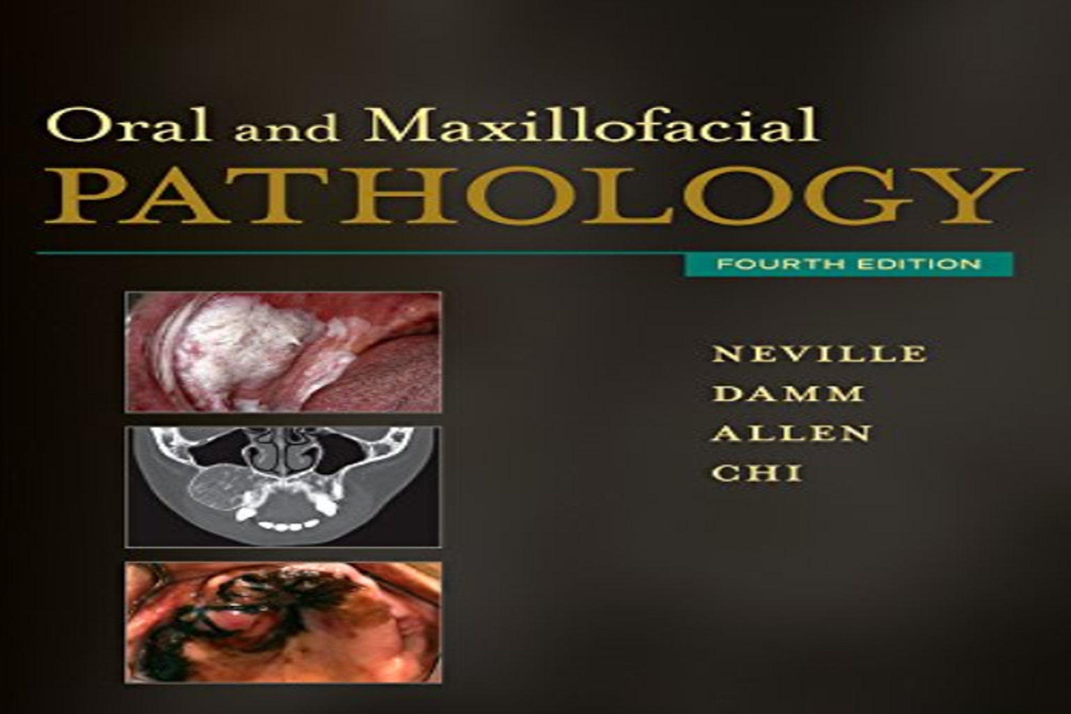 Oral and Maxillofacial Pathology Textbook – Clinical Guide & Free PDF